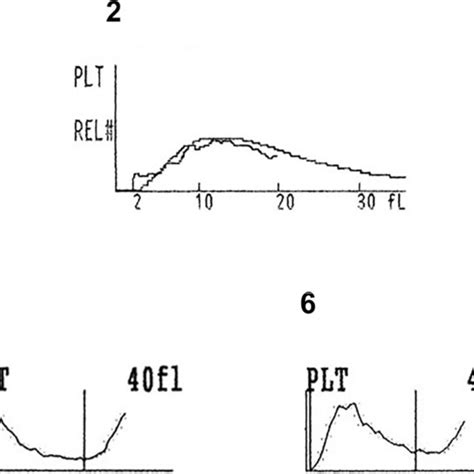 Platelet Clumps Of Medium And Large Size With Compacted Platelets In