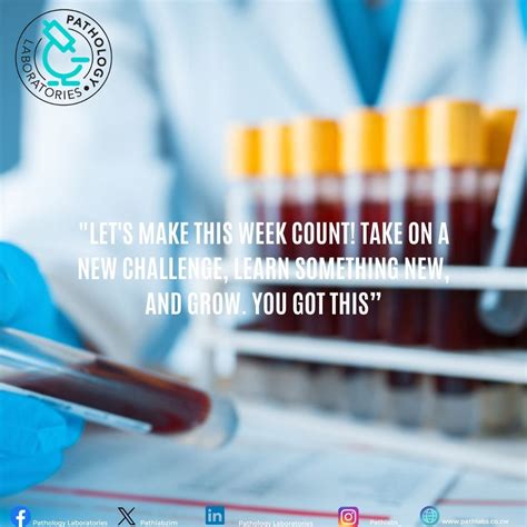 Tinotenda Mtetwa Posted On Linkedin