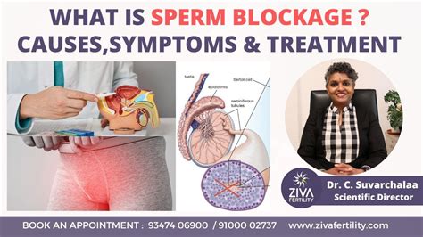 Sperm Blockage Causes Symptoms And Treatment Male Infertility Dr
