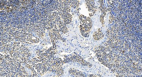 Cd226 Antibody 82991 3 Rr Proteintech