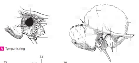 Diagram Of Anatomy Practical Tympanic Ring And Temporal Bone Quizlet