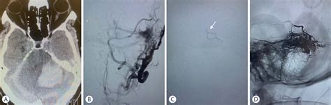 Patients Demographics