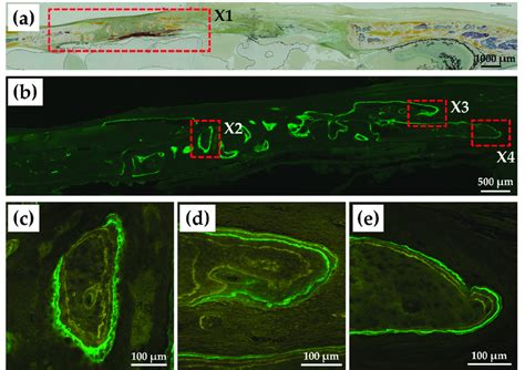 A Villanueva Stained Image Of A Rat Cranial Bone Defect 8 Weeks After Download Scientific
