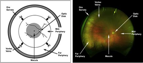 The Clinical Relevance Of Visualising The Peripheral Retinaprogress In