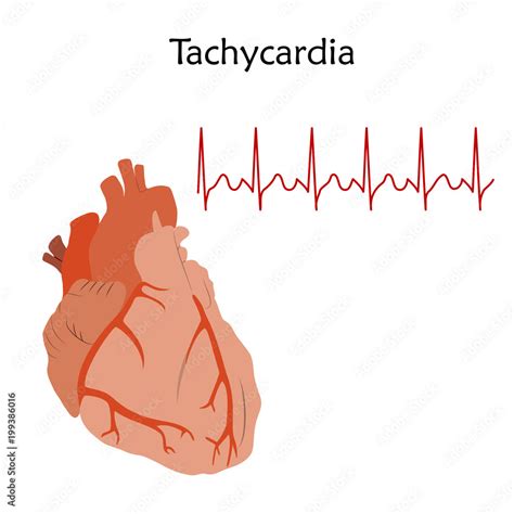 Human Heart Tachycardia Anatomy Flat Illustration Red Image White