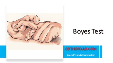 Duncan Ely Test Orthofixar 2025