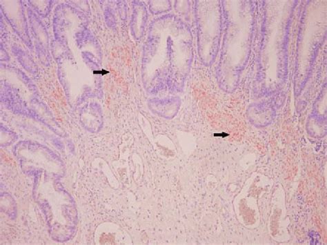 Positive Immunolabelling Arrows Of Muscle Cells In The Polyp Stroma