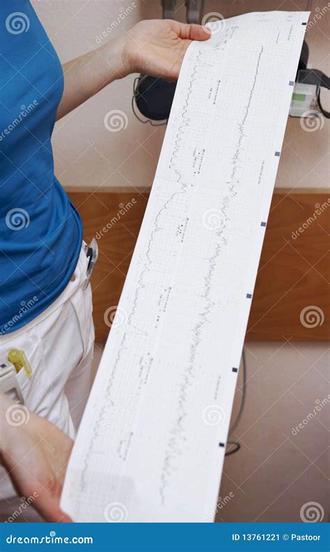 Medical Graph Of Contractions Stock Image Image Of Examination Caucasian 13761221