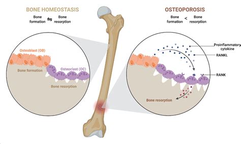 Figure 1 From Immunoporosis Role Of Innate Immune Cells In
