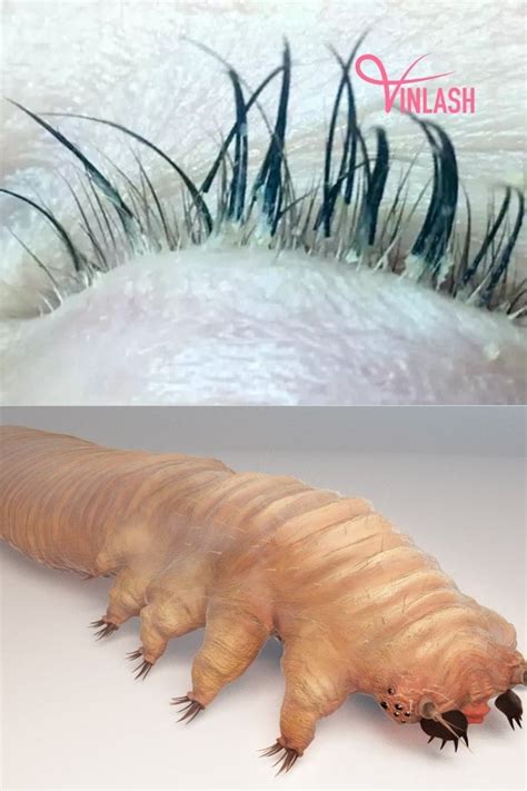 A Guide To Deal With Lash Mites Eyelash Extensions