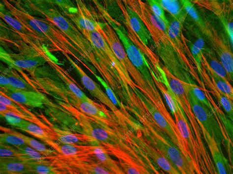 Skeletal Muscle Cells Light Micrograph Stock Image C025 3218