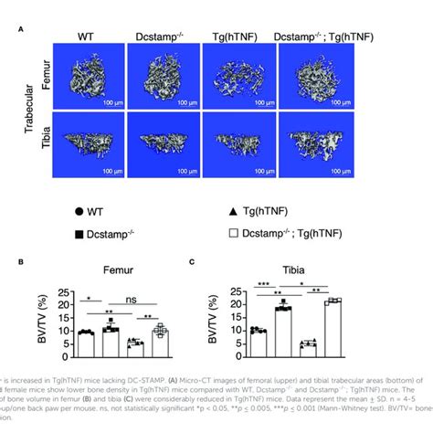 Inflammatory Arthritis And Pathologic Bone Resorption Are Markedly