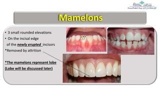 2 Anatomical Landmarks And Dental Tissues Pptx