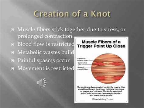 What Exactly Is A Knot In A Muscle At Echo Stone Blog