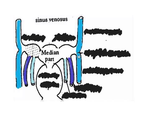 Sinus Venosus Quiz