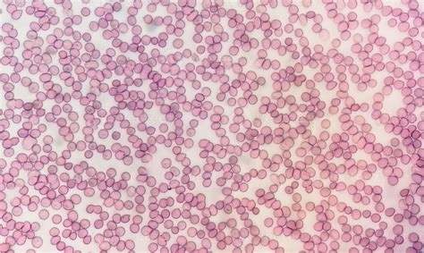 Platelet Colour In Microscope