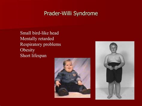 Ppt Sex Linked Traits And Karyotypes Powerpoint Presentation Free