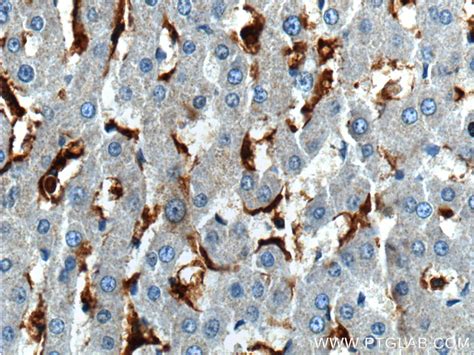 Cd16 Antibody 16559 1 Ap Proteintech