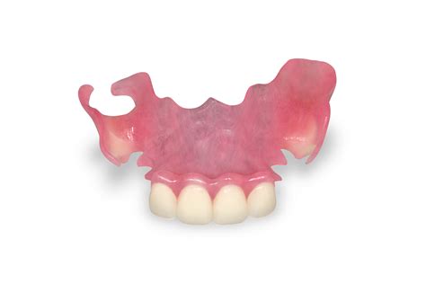Flexible Partial Dentures