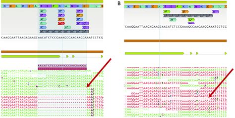 Qci Analyze Qci A Results Of Patient 11 Showing The Alignment Of The