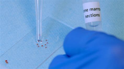 Video Proplatelet Formation Dynamics Of Mouse Fresh Bone Marrow Explants