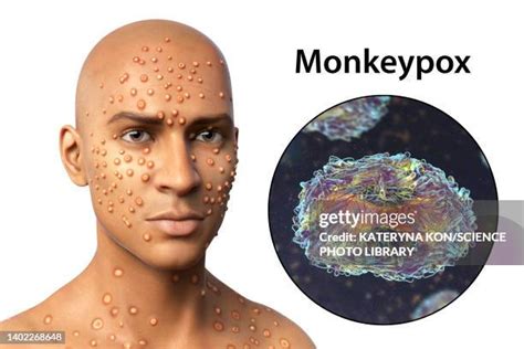 209 Man Skin Problems High Res Illustrations Getty Images