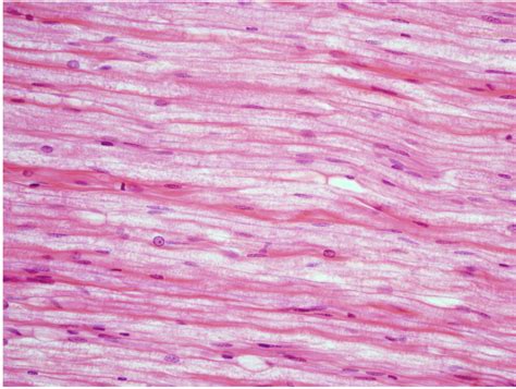 Nerve Longitudinal Section Diagram Quizlet