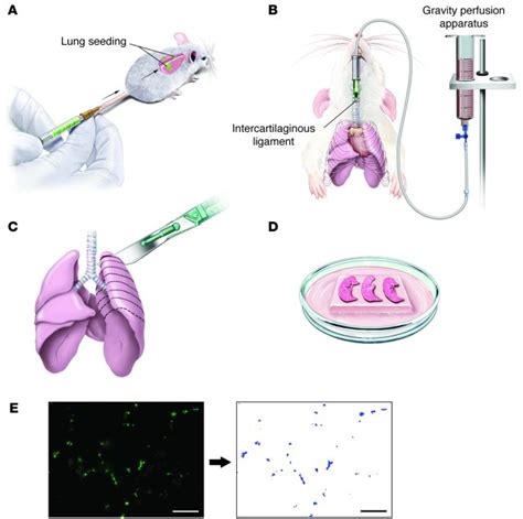 Jci Modeling Metastasis Biology And Therapy In Real Time In The Mouse