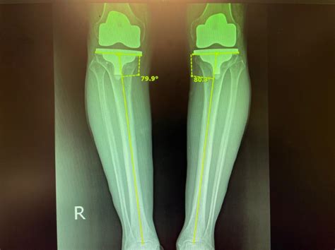 Tab Bone Posted On Linkedin