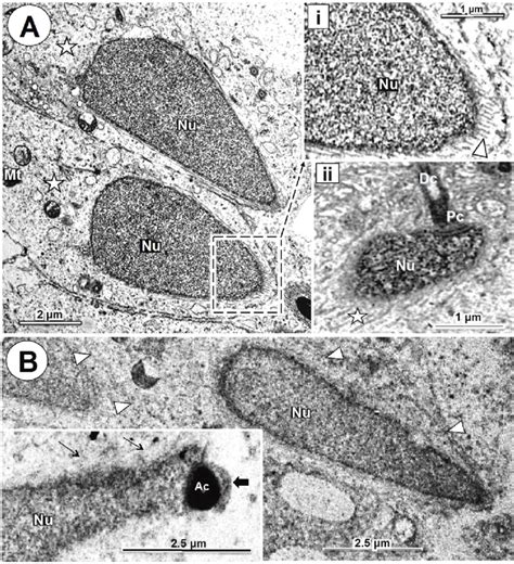 Step 6 Spermatids A The Spermatid Nucleus Nu Is Pyramidal Or