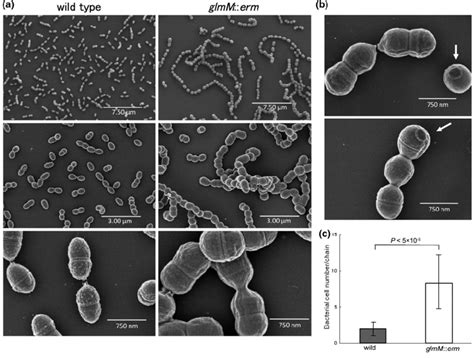 Strep Throat Bacteria Under Microscope