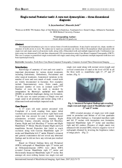 Pdf Single Rooted Posterior Teeth A Rare Root Dysmorphism Three