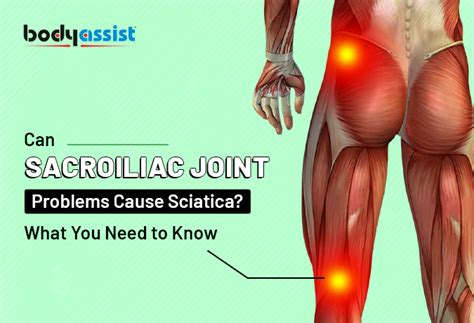 Can Sacroiliac Joint Problems Cause Sciatica What You Need To Know