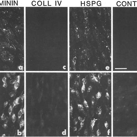 Proliferation Of Basal Keratinocytes Is Increased In The Skin Of