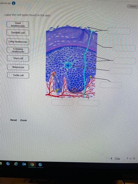 Solved Ollow Up Label The Cell Types Found In The Skin Dead
