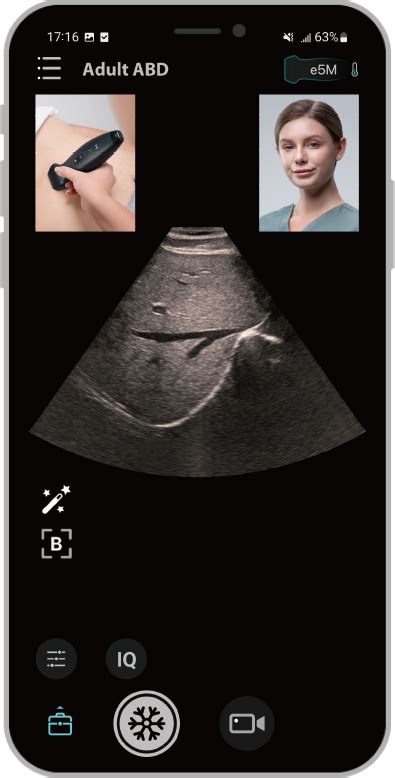 Te Air E5m Wireless Handheld Ultrasound System Mindray