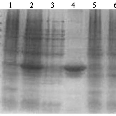 Western Blot Analysis Of Recombinant Hypothetical Secreted Protein Of