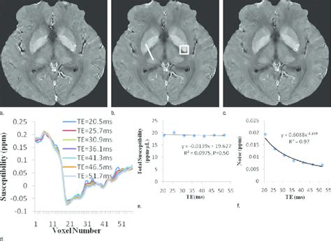 Qualitative And Quantitative Analysis Of The Qsm Profi Le In A Download Scientific Diagram