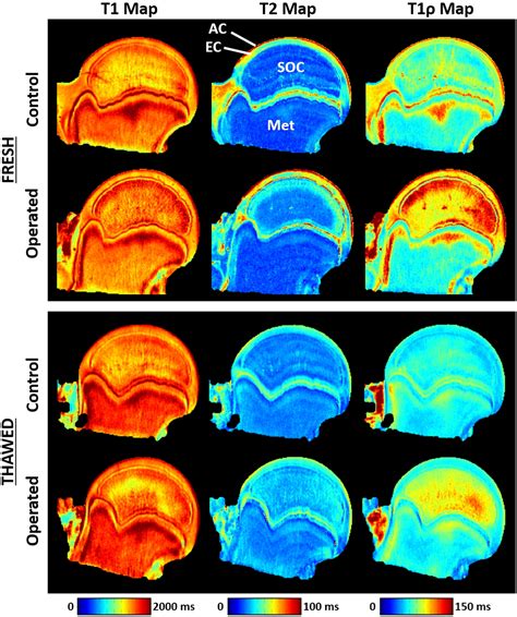 Table 1 Magnetization Prepared2d Fse Imaging Parameters For