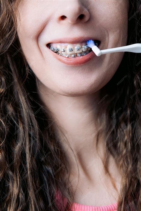 Premium Photo Young Woman Brushes Her Teeth With Braces With A Monobeam Brush Closeup