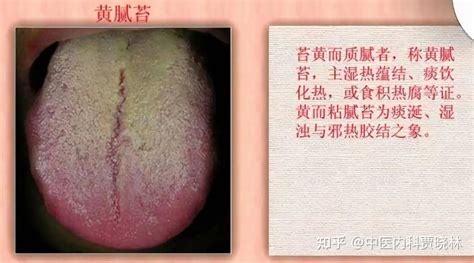 湿热下注？二妙丸配一物，大腿潮湿、瘙痒皆可用 知乎