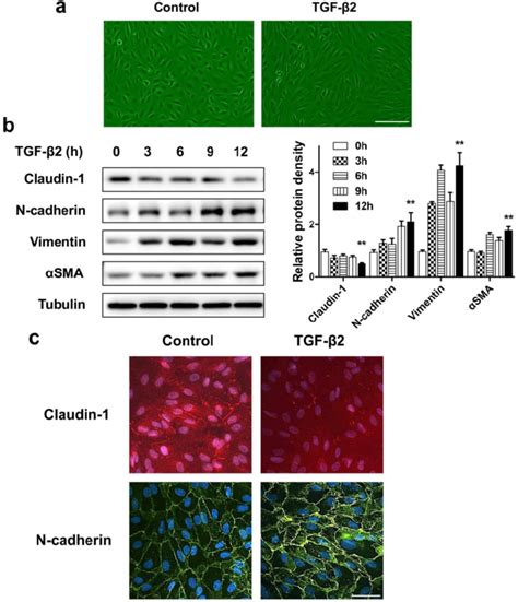Arpe 19 Cell Monolayer Transit Into Fibroblastoid Phenotype Under Emt