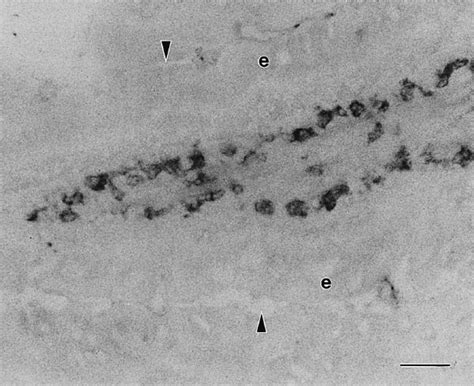 Immunohistochemical Staining Of A Cryosection Of The Gut Of A