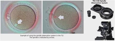 Microscopy Appnote Ivf Icsi Reproductivemedicine Art Nikon