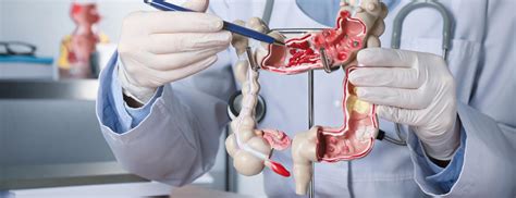 Proctectomy Johns Hopkins Medicine