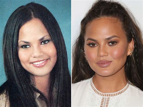 8 Celebrities Who Have Openly Admitted To Having Plastic Surgery