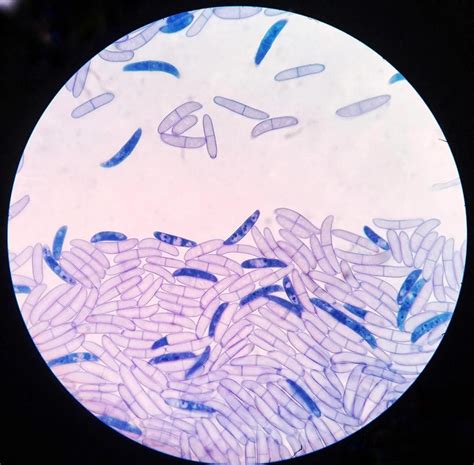 镰刀菌形态染色与培养特性