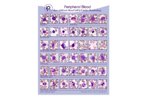 Peripheral Blood Normal White Blood Cell And Platelet Morphology