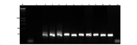 Figure E Sensitivity Test Of The Nested Polymerase Chain Reaction Download Scientific Diagram