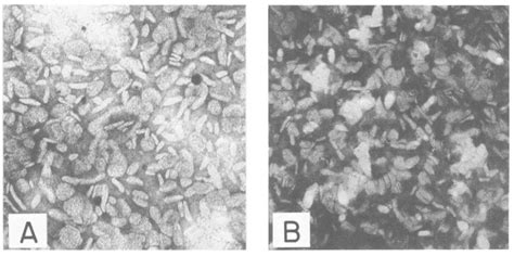 Figure 1 From Reassembly Of Lipid Protein Complexes Of Pulmonary